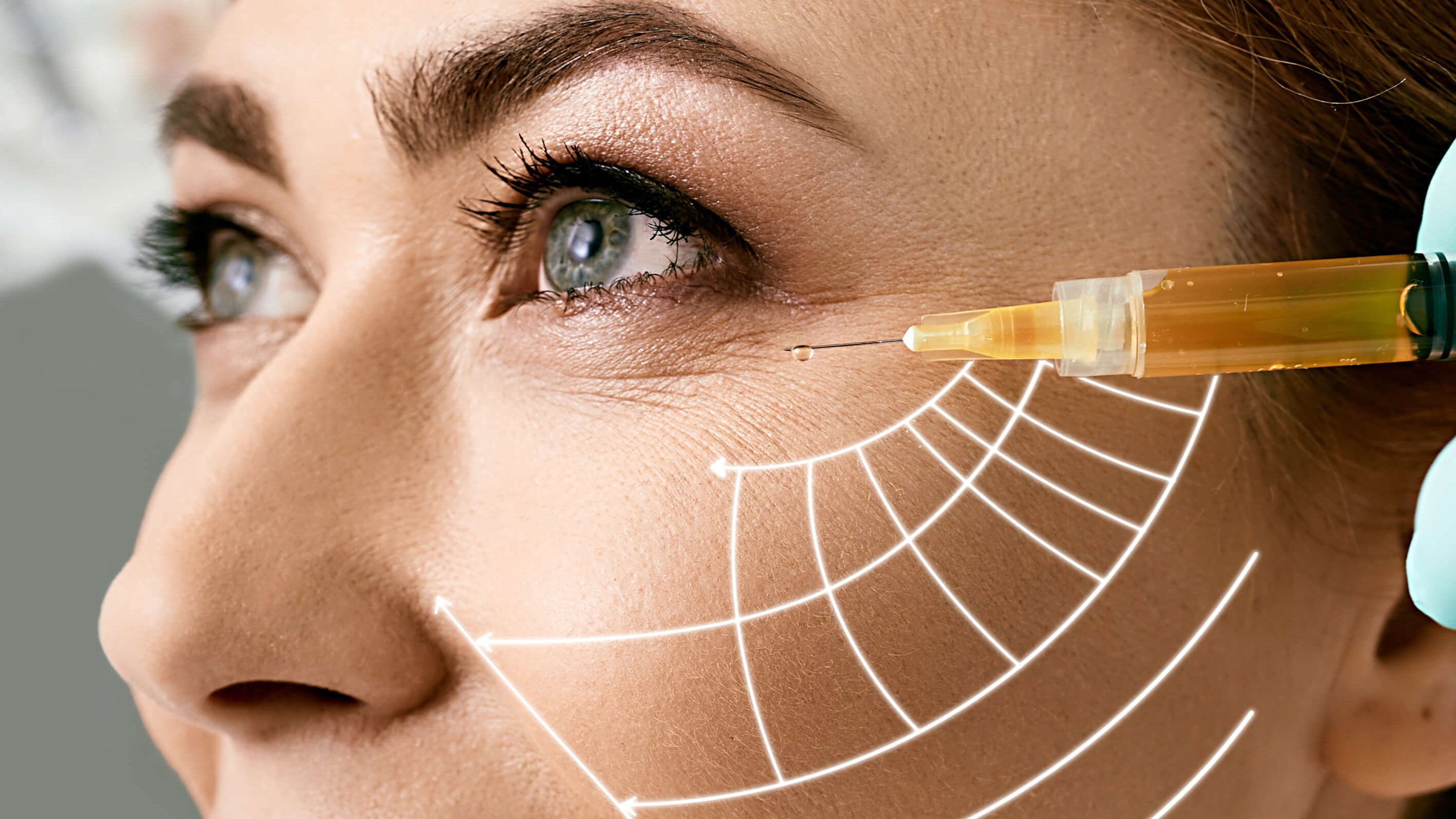 DermaGel: Is this the Dermal Filler of the Future in Springfield Missouri?